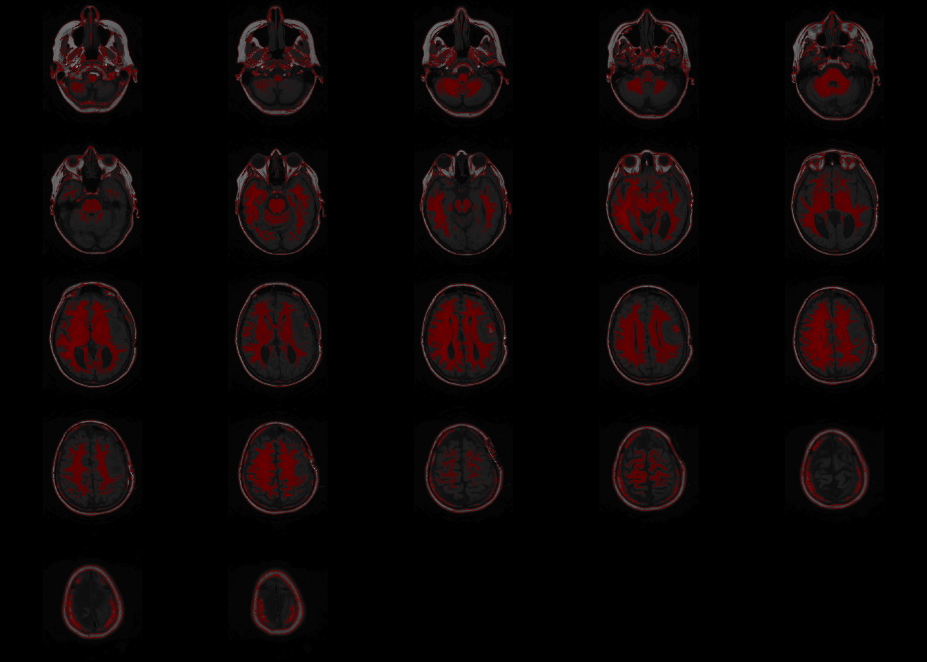 Lecture 3 Basic Visualization 08 Normalization