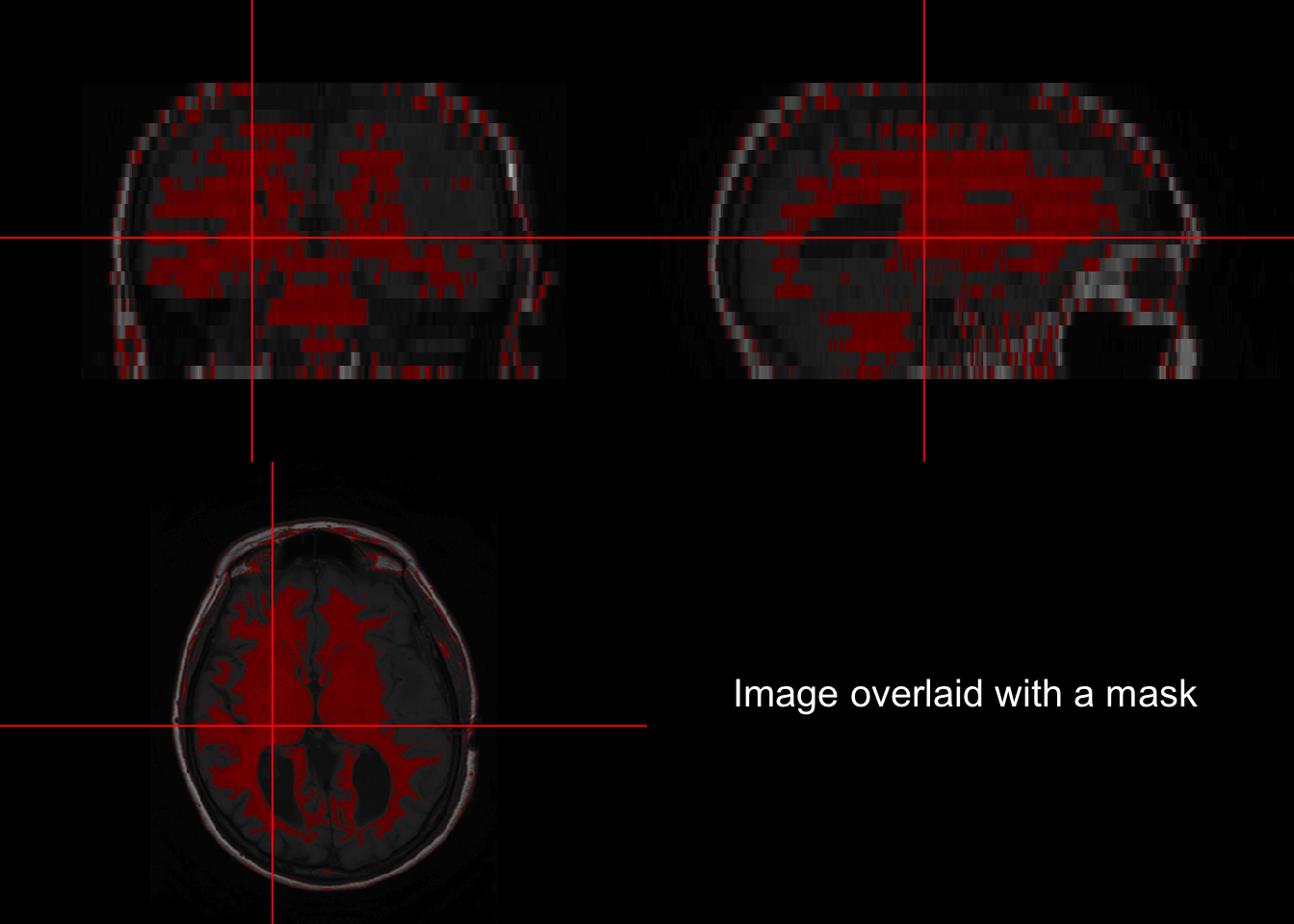 Lecture 3 Basic Visualization 08 Normalization